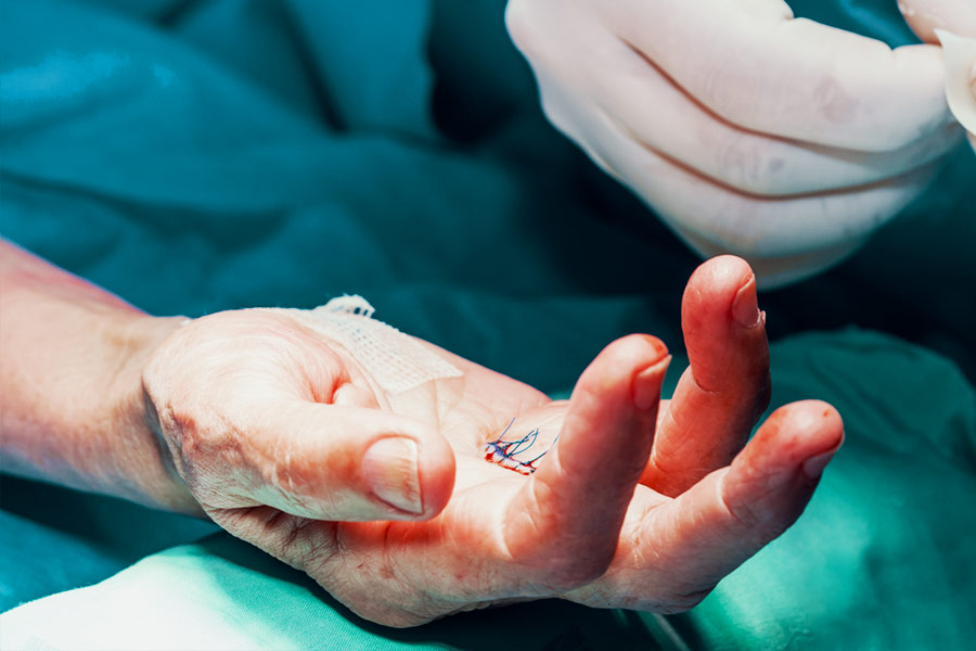 HAND SURGERY | Prof. Dr. Emre AKSU